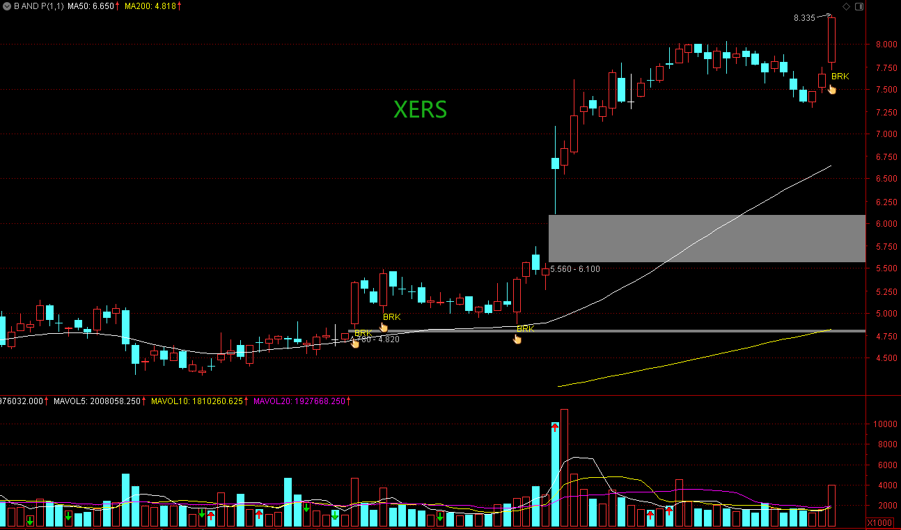Breakthrough And Pullback | 5 Stocks Deserve Close Attention: XERS ...